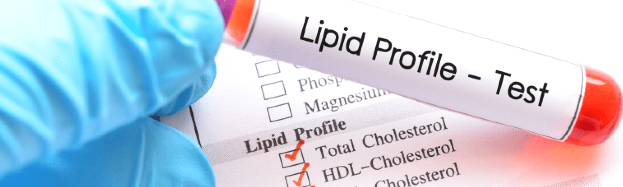 Understanding your lipid blood test results - DarioHealth